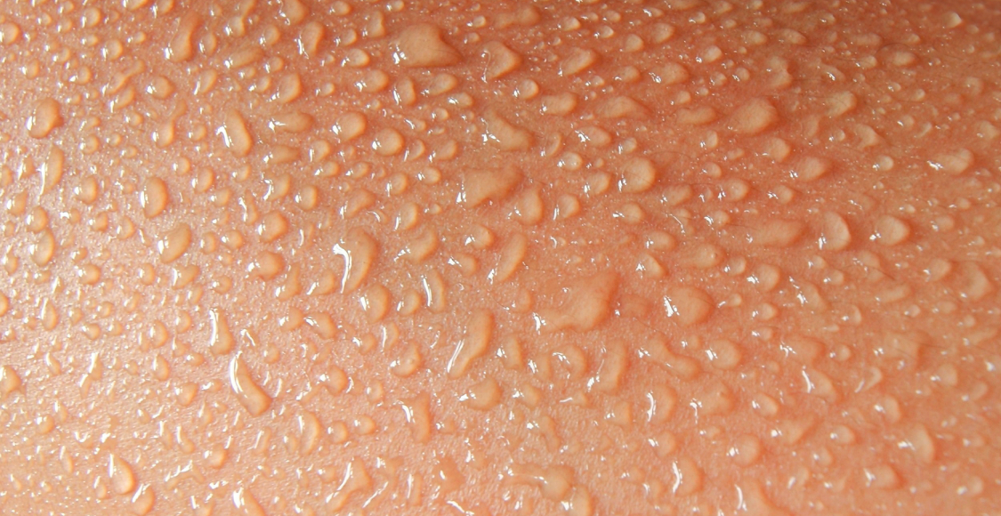 What I tell my patients: hyperhidrosis - Dermatology in practice